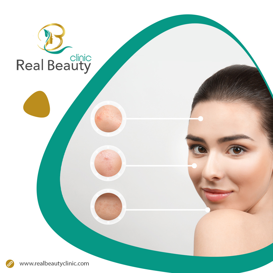 How to Manage Scarring After Cosmetic Procedures: A Complete Guide ...